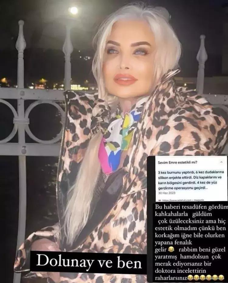 Orhan Gencebay’ın eşi Sevim Emre’den estetik açıklaması - Magazin Haberleri