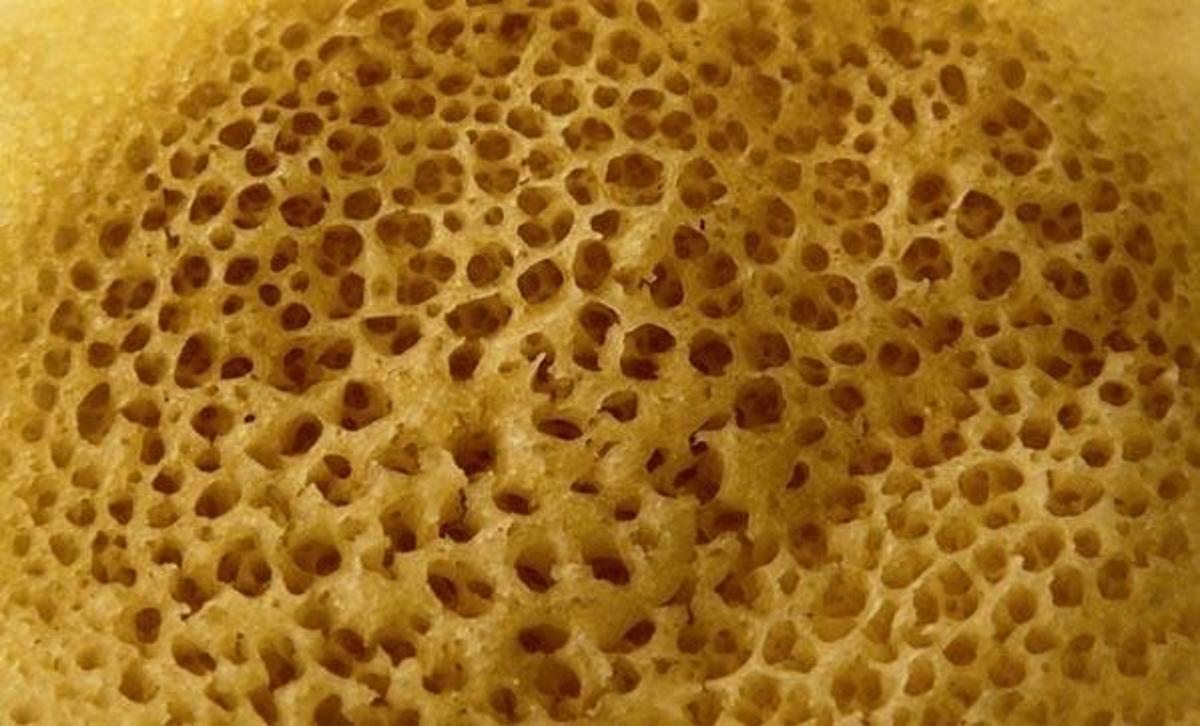 Tripofobi nedir, Tripofobi (delik fobisi) neden olur? Tripofobi ...