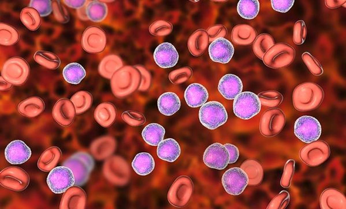 'Lenfomada uygun tedavi yönetimiyle iyileşme şansı yüksek' - Sağlık Haberleri