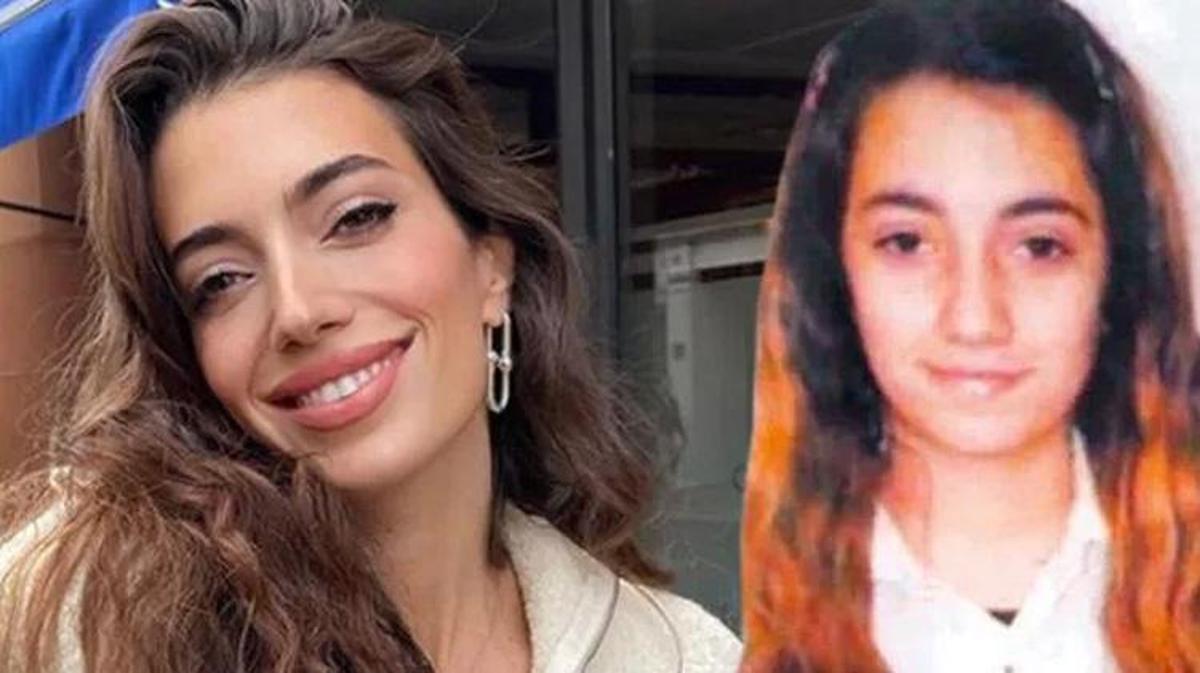 Rachel Araz 'estetik' iddiaları ile ilgili ilk kez konuştu ...