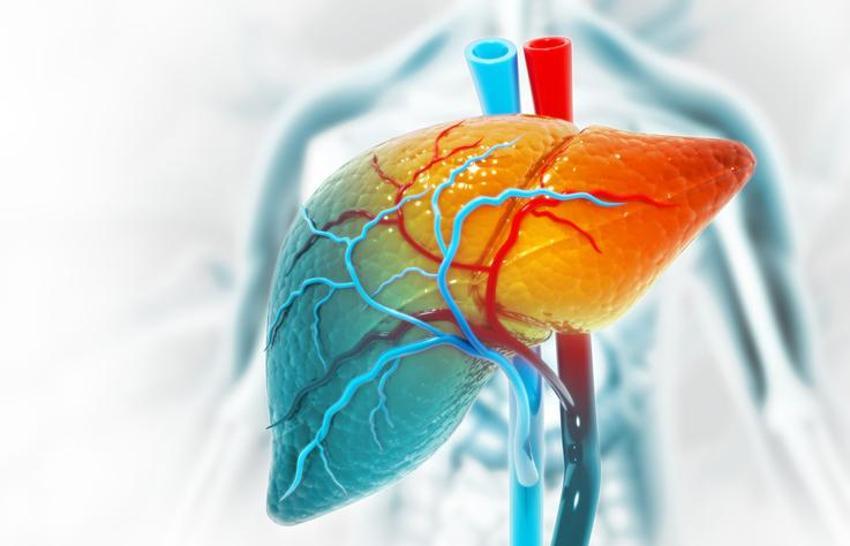 Siroz nedir, neden olur, öldürücü mü? Siroz hastalığının belirtileri ...
